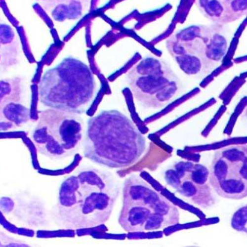 jan 1, 1752 - First clinical description of anthrax by Maret (Timeline)